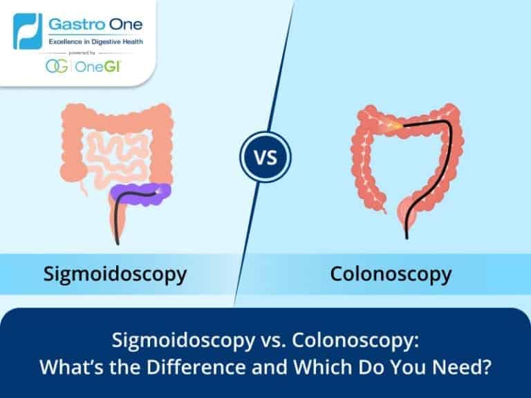 Sigmoidoscopy vs Colonoscopy: Differences, Uses, and Screening